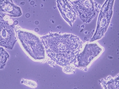 Bakterielle Vaginose | Prof. Dr. med. Werner Mendling